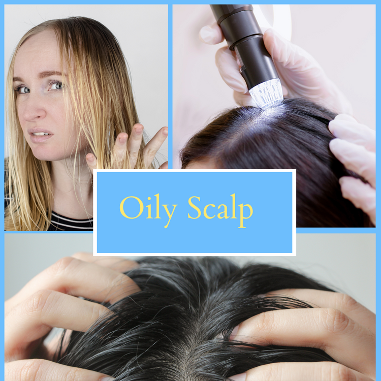 Sebum Control Solutions. Oily Scalp. Expert Tips. Real Results. – Skin ...